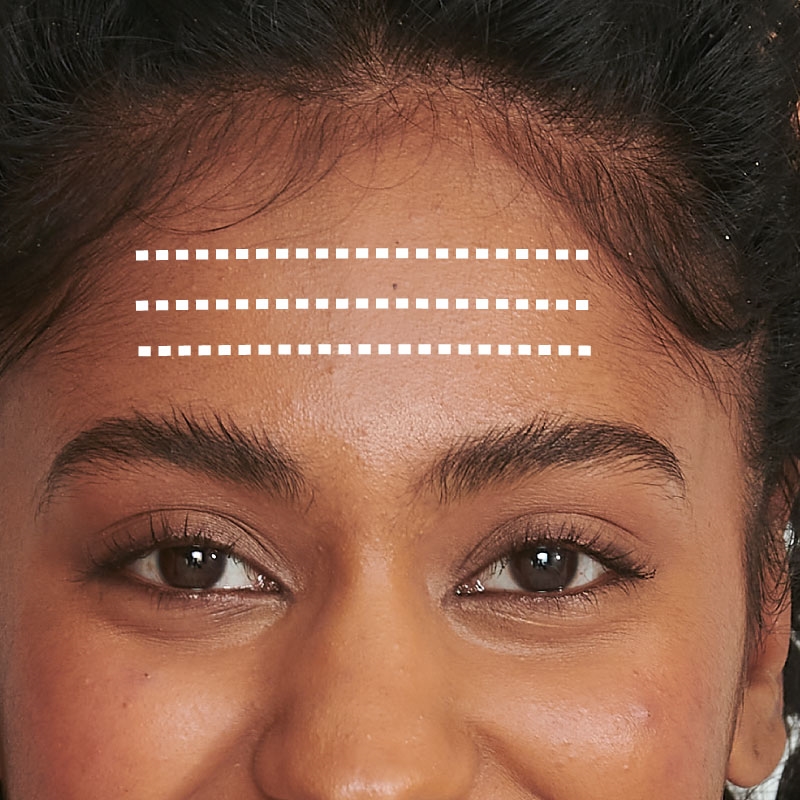 Results Laser Clinic, Australia's No.1 choice for laser hair removal ...