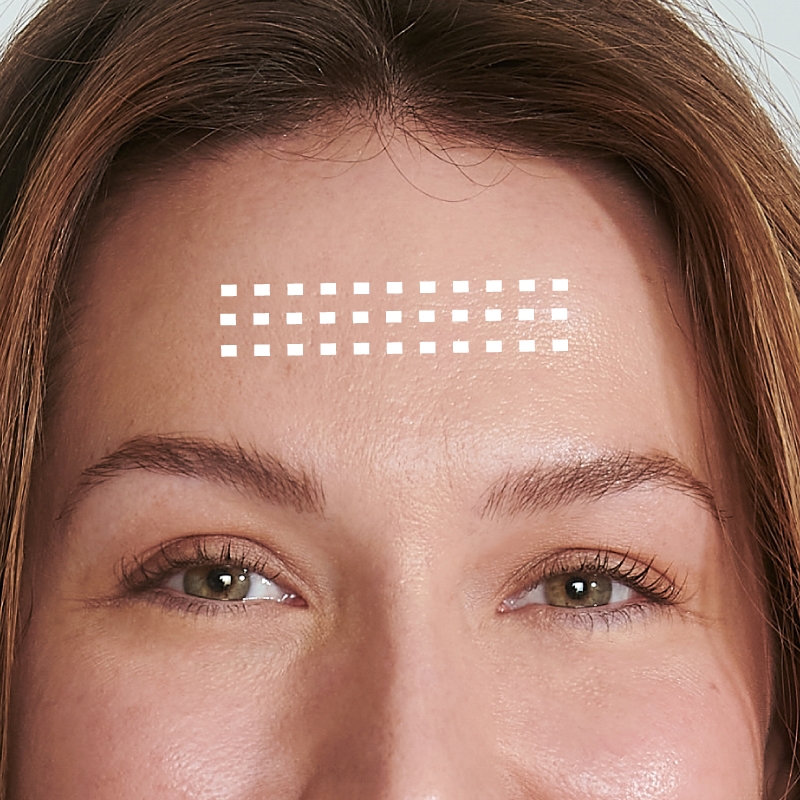 Results Laser Clinic, Australia's No.1 choice for laser hair removal ...