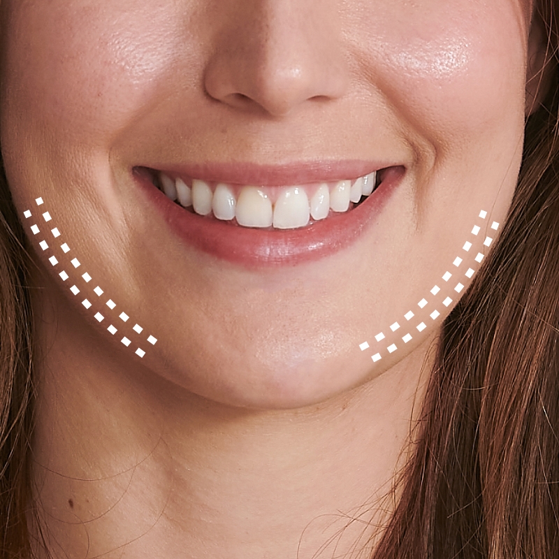 Results Laser Clinic, Australia's No.1 choice for laser hair removal ...