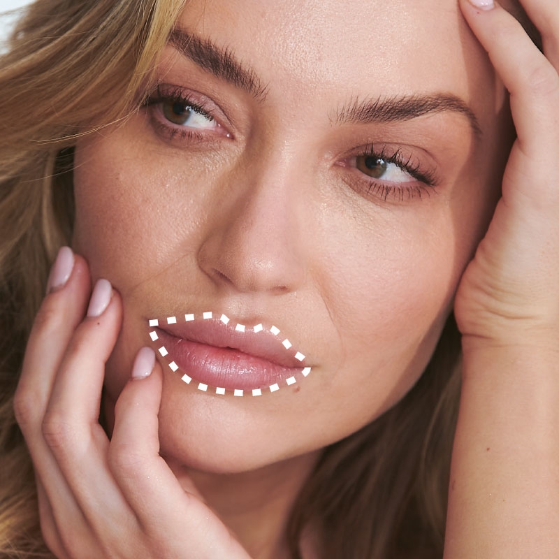 Results Laser Clinic, Australia's No.1 choice for laser hair removal ...