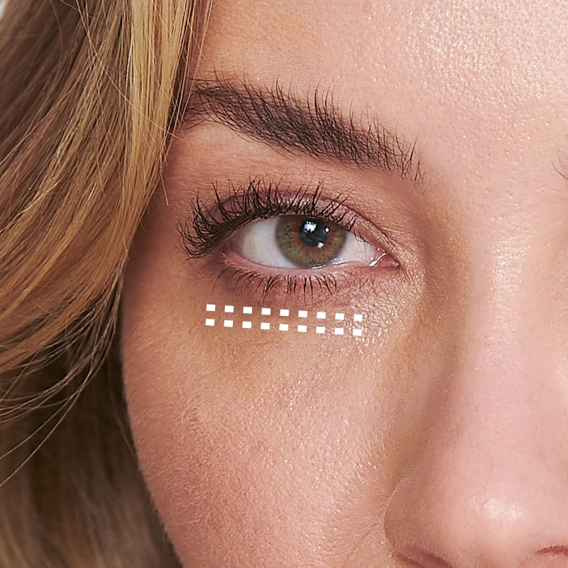 Results Laser Clinic, Australia's No.1 choice for laser hair removal ...